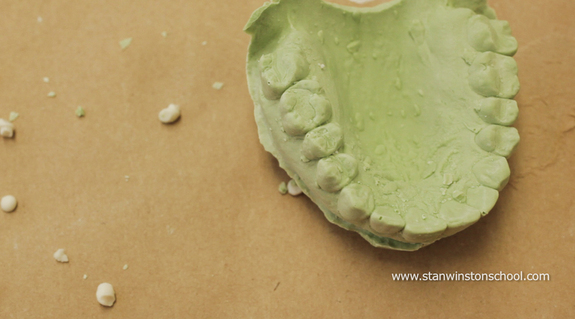 Dental Casting Techniques for Creating Fake Teeth - FREE Mini-Lesson by ...