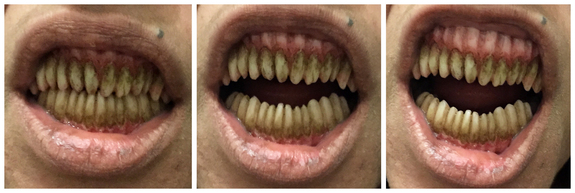 How to Make Wearable Creature Teeth with SWSCA students Rosanna Wells ...